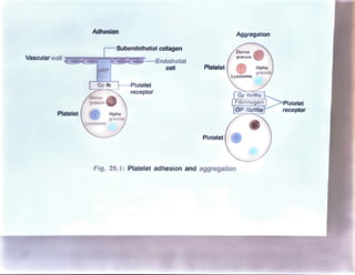 Bleeding disorder (pathology).pdf