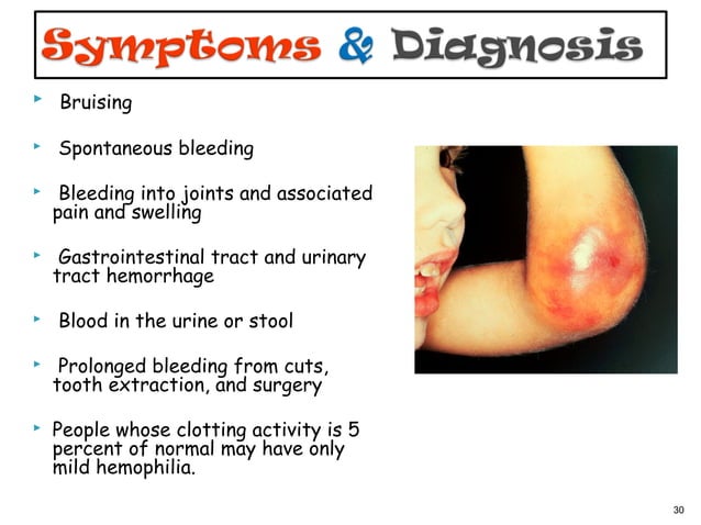 Bleeding disorders | PPT