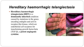 BLEEDING DISORDERS.pptx