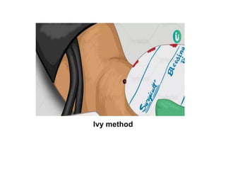 Bleeding disorders_eed49ebf24e8f72ee8b3419525d0414f copy.pptx