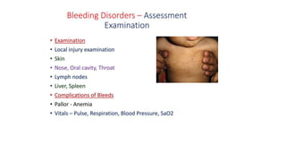 Bleeding Disorders In Children .pptx