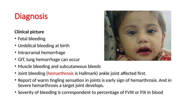 BLEEDING DISORDERS IN CHILDREN.0 (1).pptx