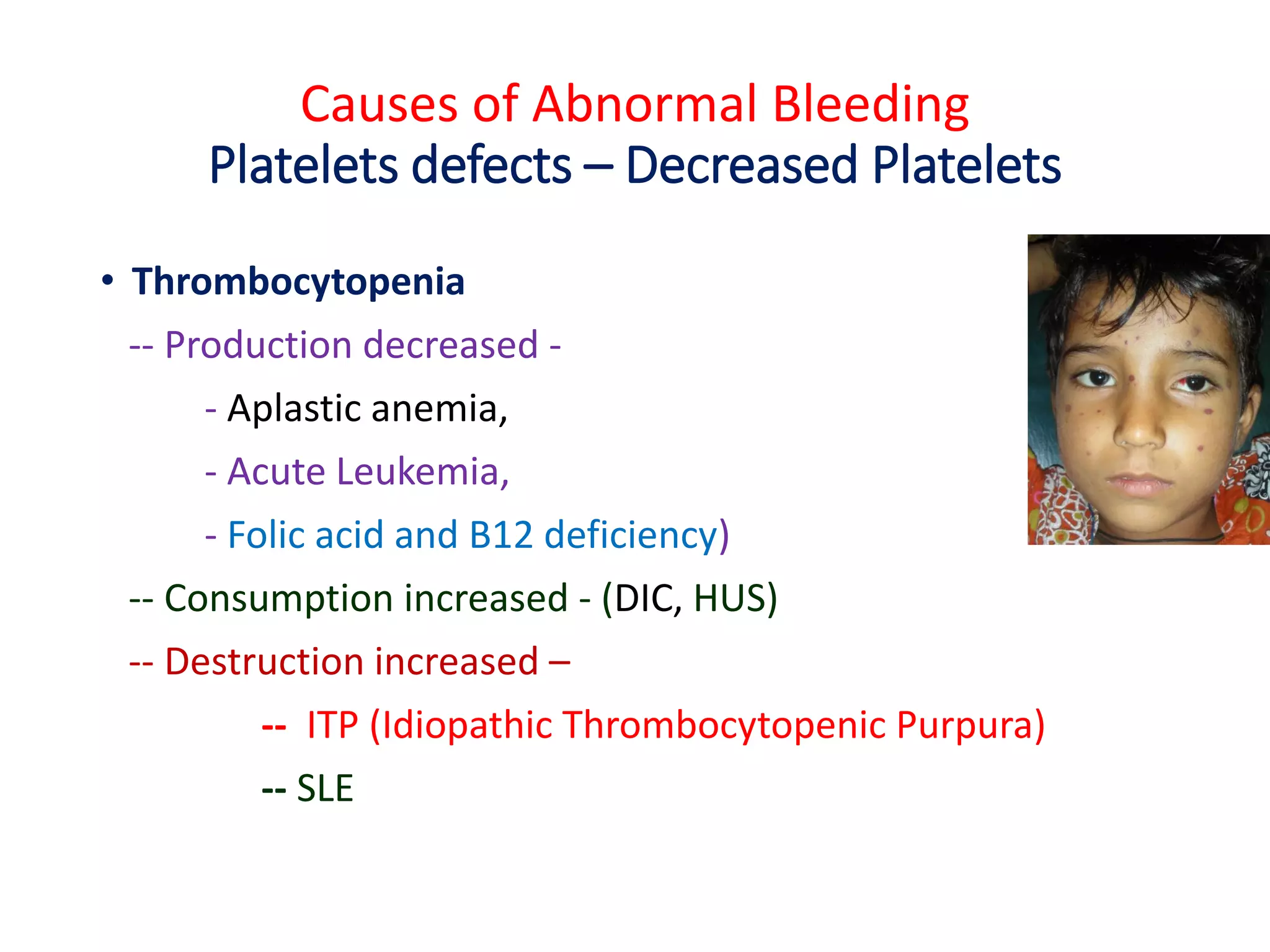 Bleeding disorders in children 2021 | PDF