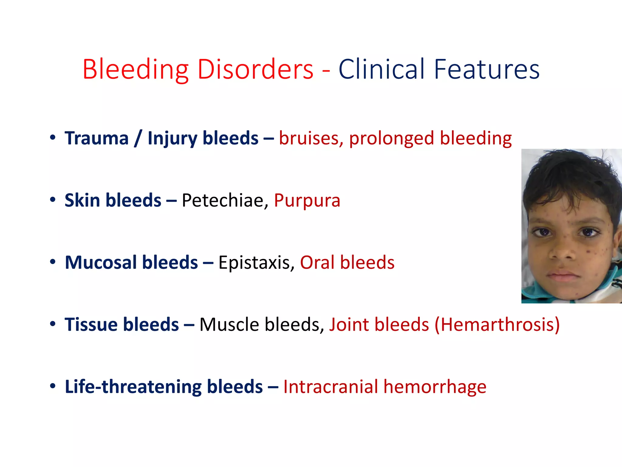 Bleeding disorders in children 2021 | PDF