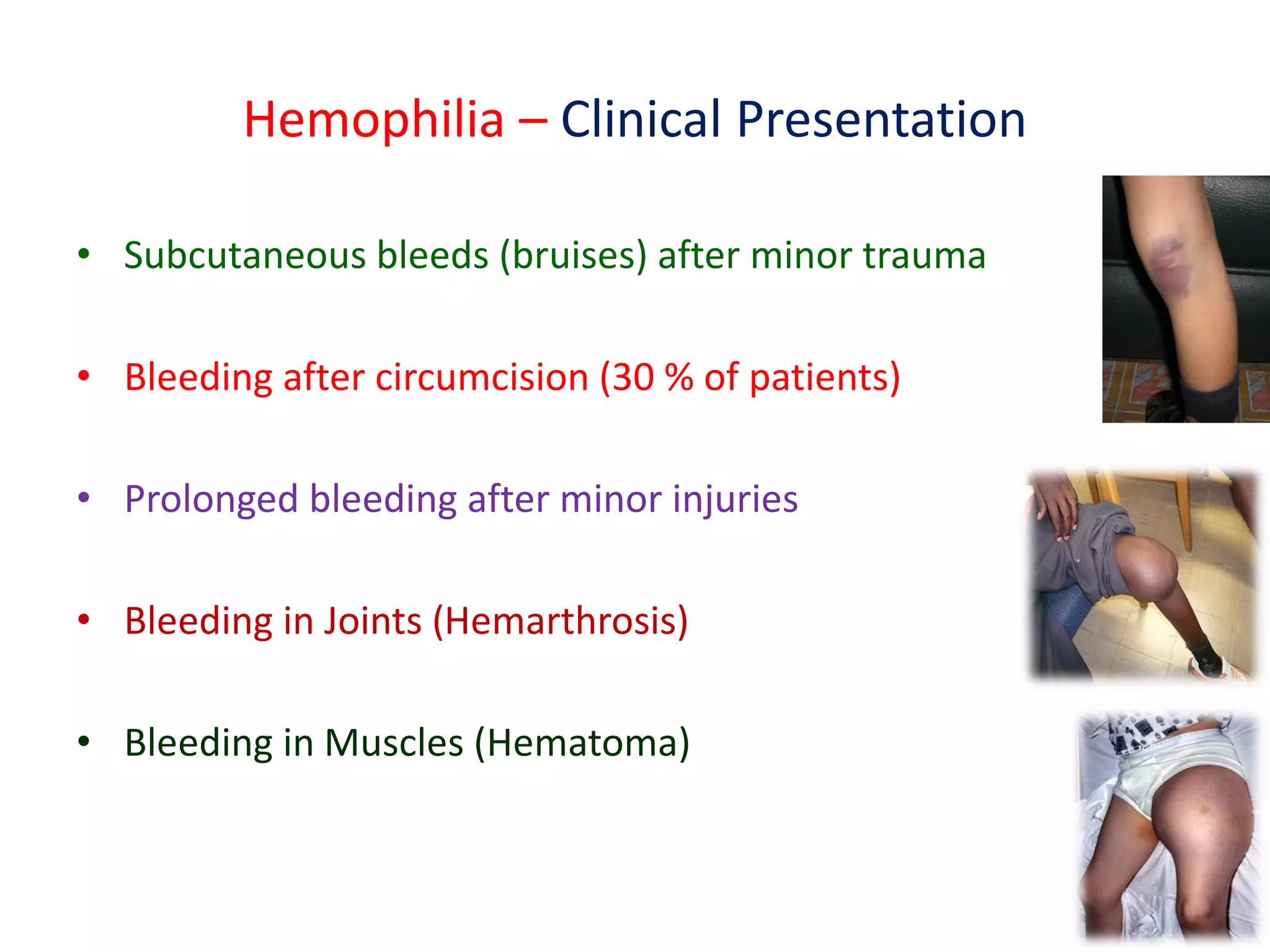 Bleeding disorders in children 2021 | PDF