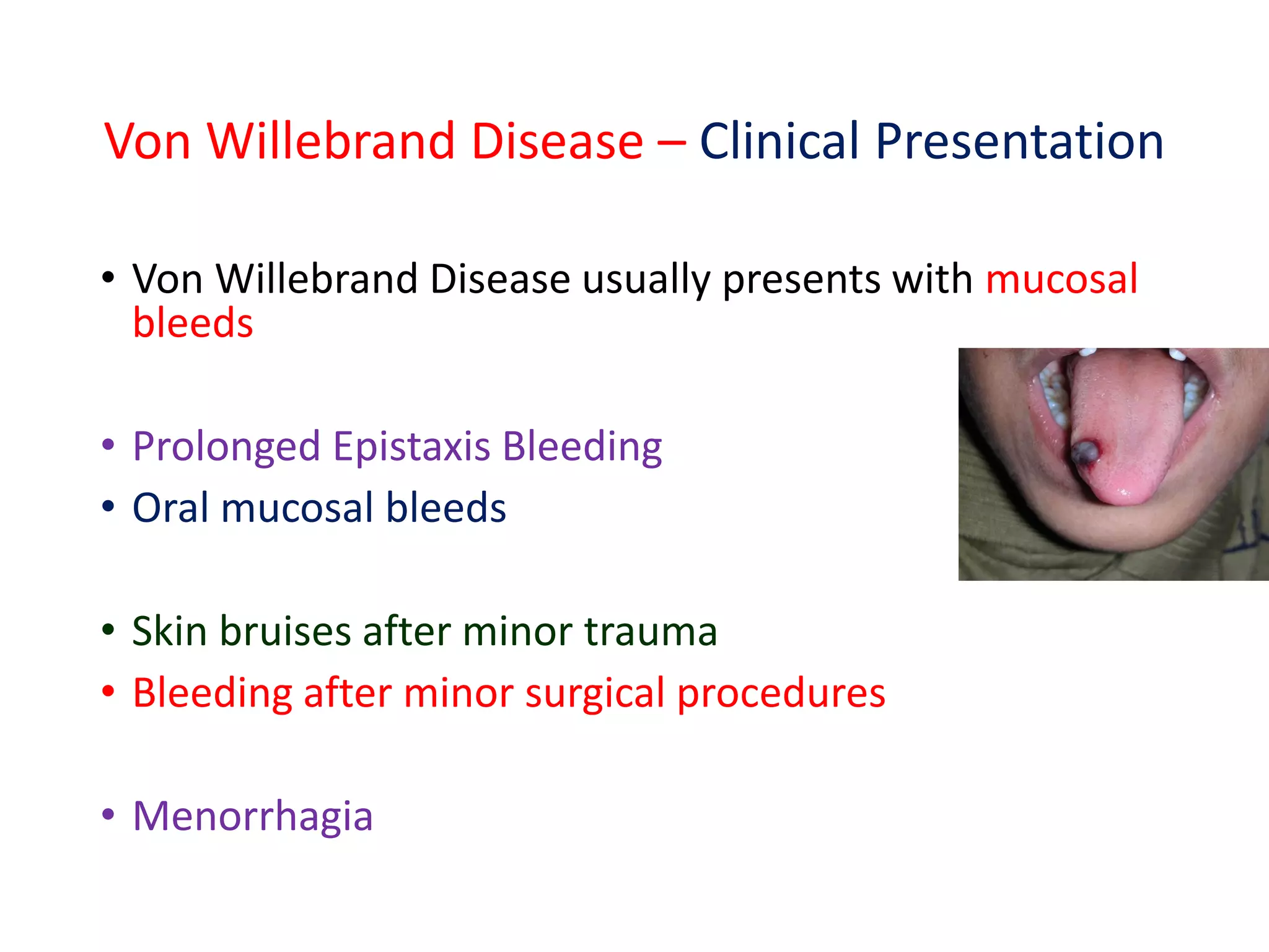 Bleeding disorders in children 2021 | PDF