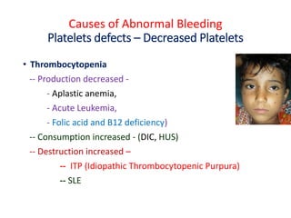 Bleeding disorders in children 2021 | PDF
