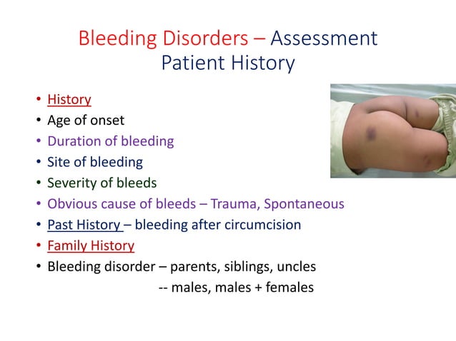 Bleeding disorders in children 2021 | PDF