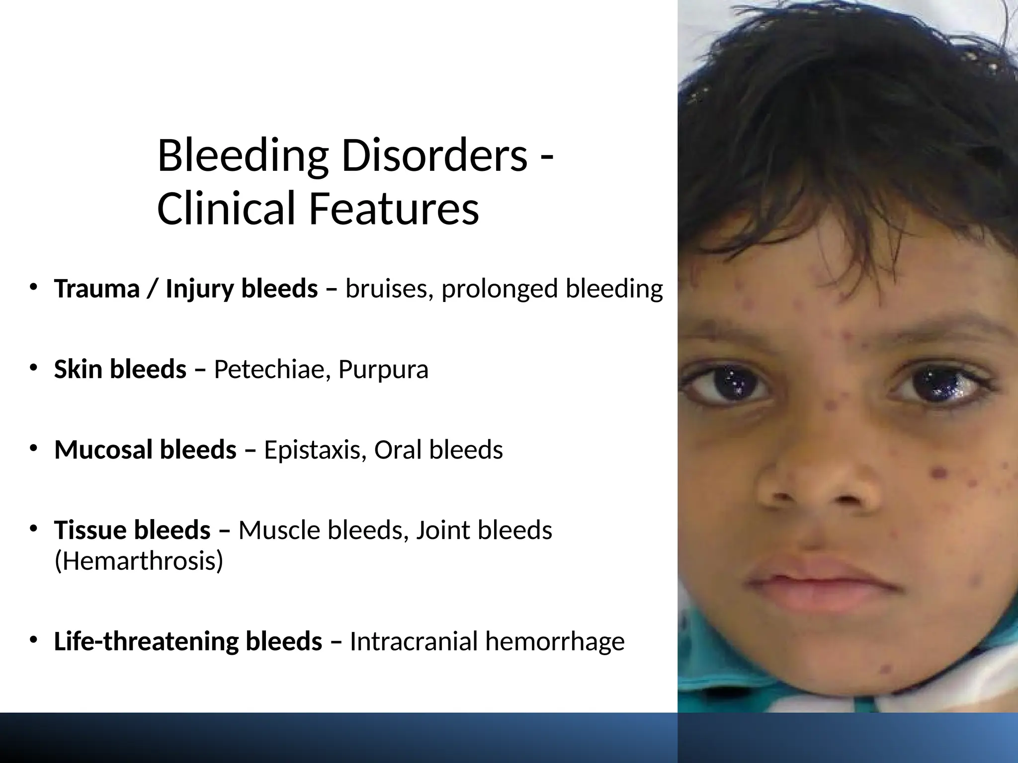 bleedingdisordersinchildren2021-210709092146 (1) (1).pptx