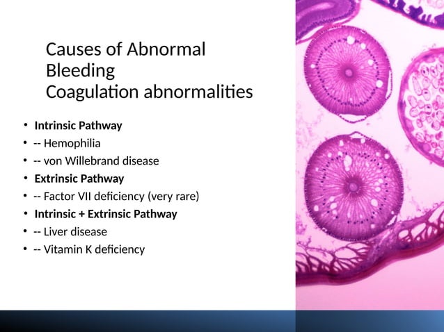 bleedingdisordersinchildren2021-210709092146 (1) (1).pptx