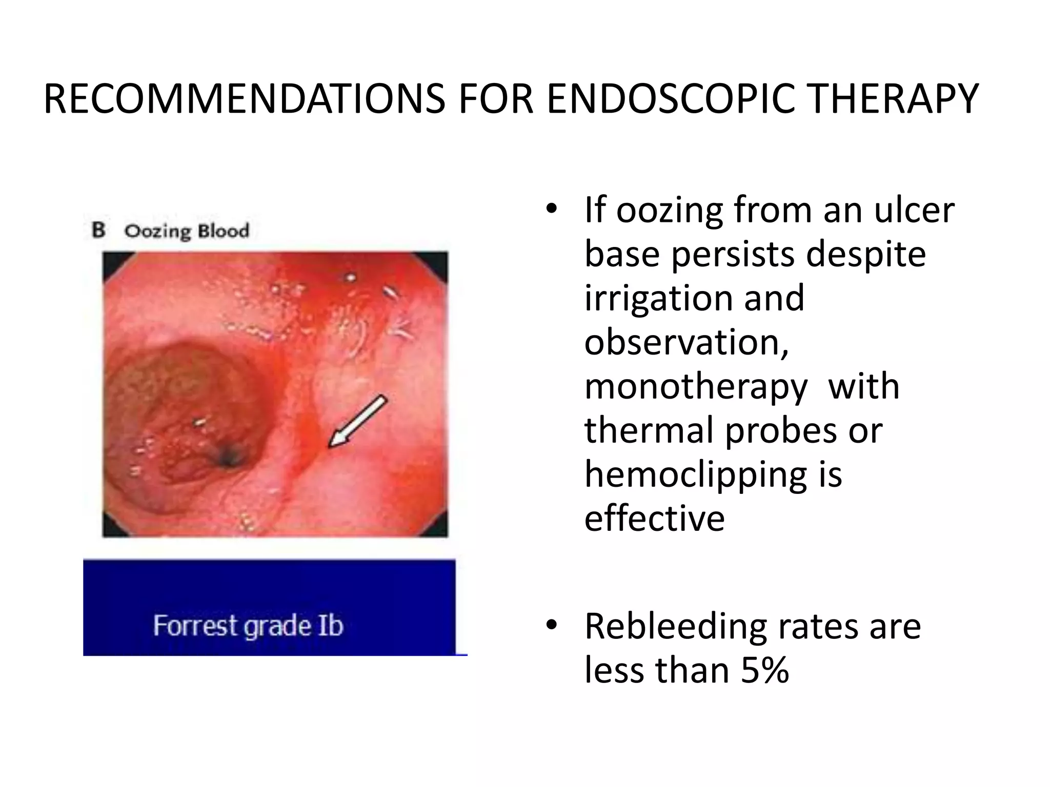 Bleeding duodenal ulcer | PPTX