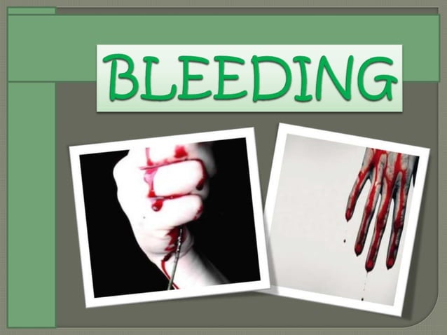 Bleeding first aid | PPTX | First Aid | Injuries