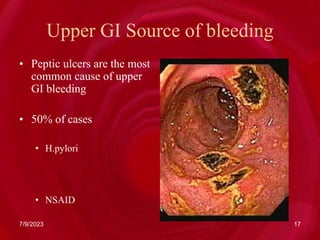 Bleeding git.ppt