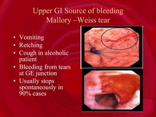Bleeding git.ppt