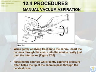 XUẤT HUYẾT TRONG THAI KỲ | PPT