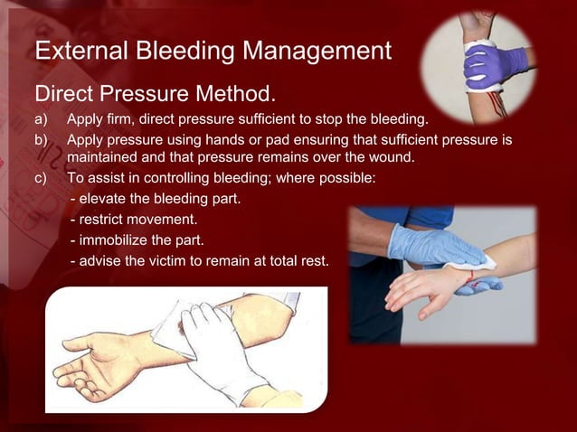 bleedingmanagement-131212142748-phpapp01.pdf