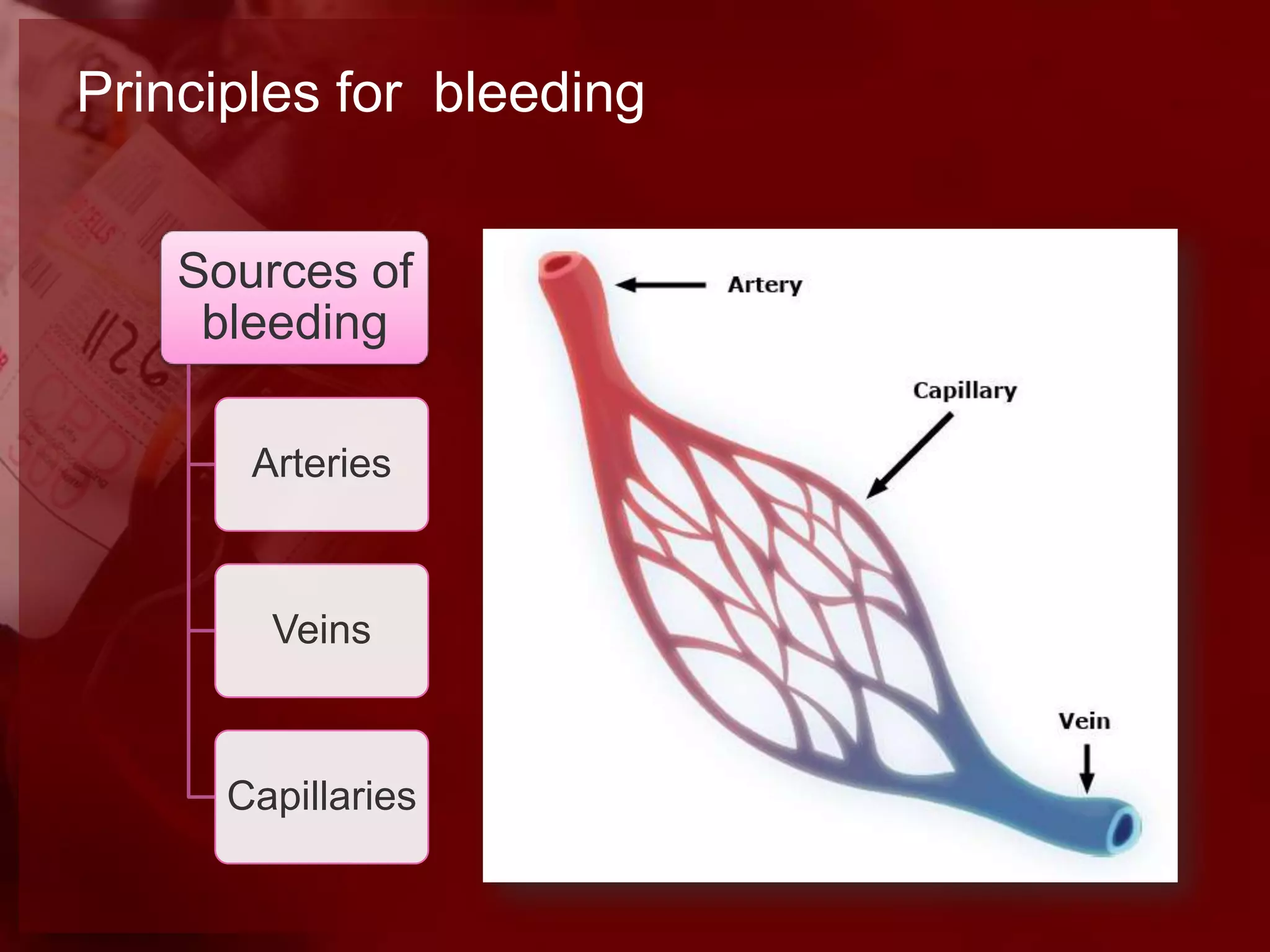 Bleeding management | PPTX