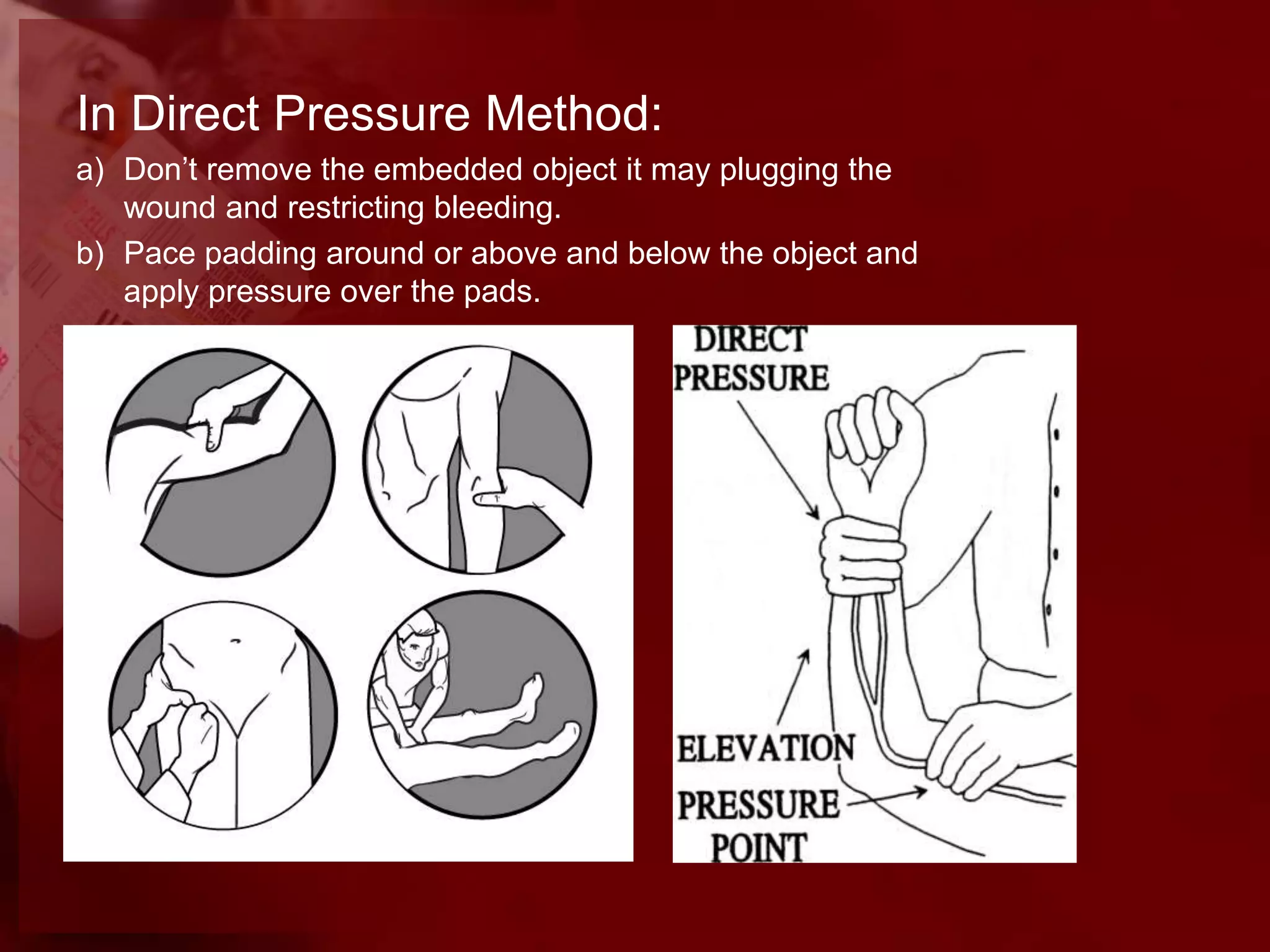 Bleeding management | PPTX