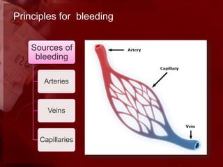 Bleeding management | PPTX