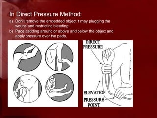 Bleeding management | PPTX