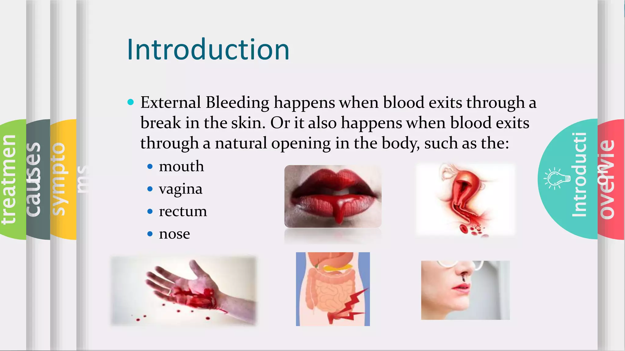 Bleeding | PPT