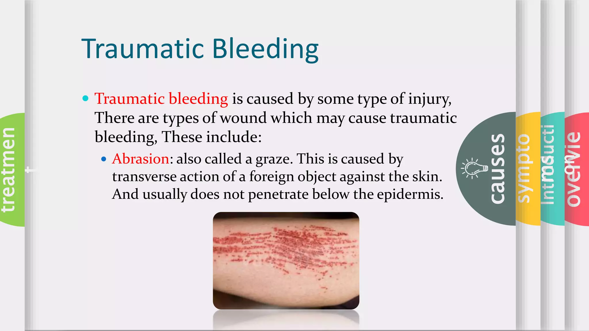 Bleeding | PPT
