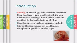 Bleeding | PPT
