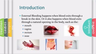 Bleeding | PPT