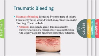 Bleeding | PPT
