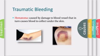 Bleeding | PPT
