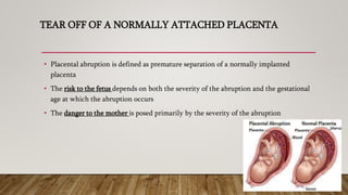 BLEEDING NEW XII.pptx