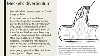 bleeding per -rectum.ppt | Digestive Disorders | Diseases and Conditions