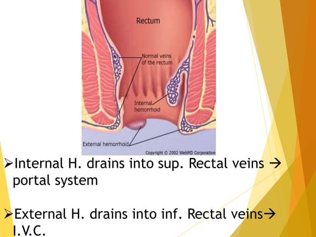 Bleeding per rectum | PPTX