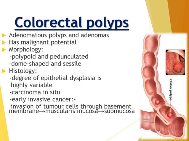 Bleeding per rectum | PPTX