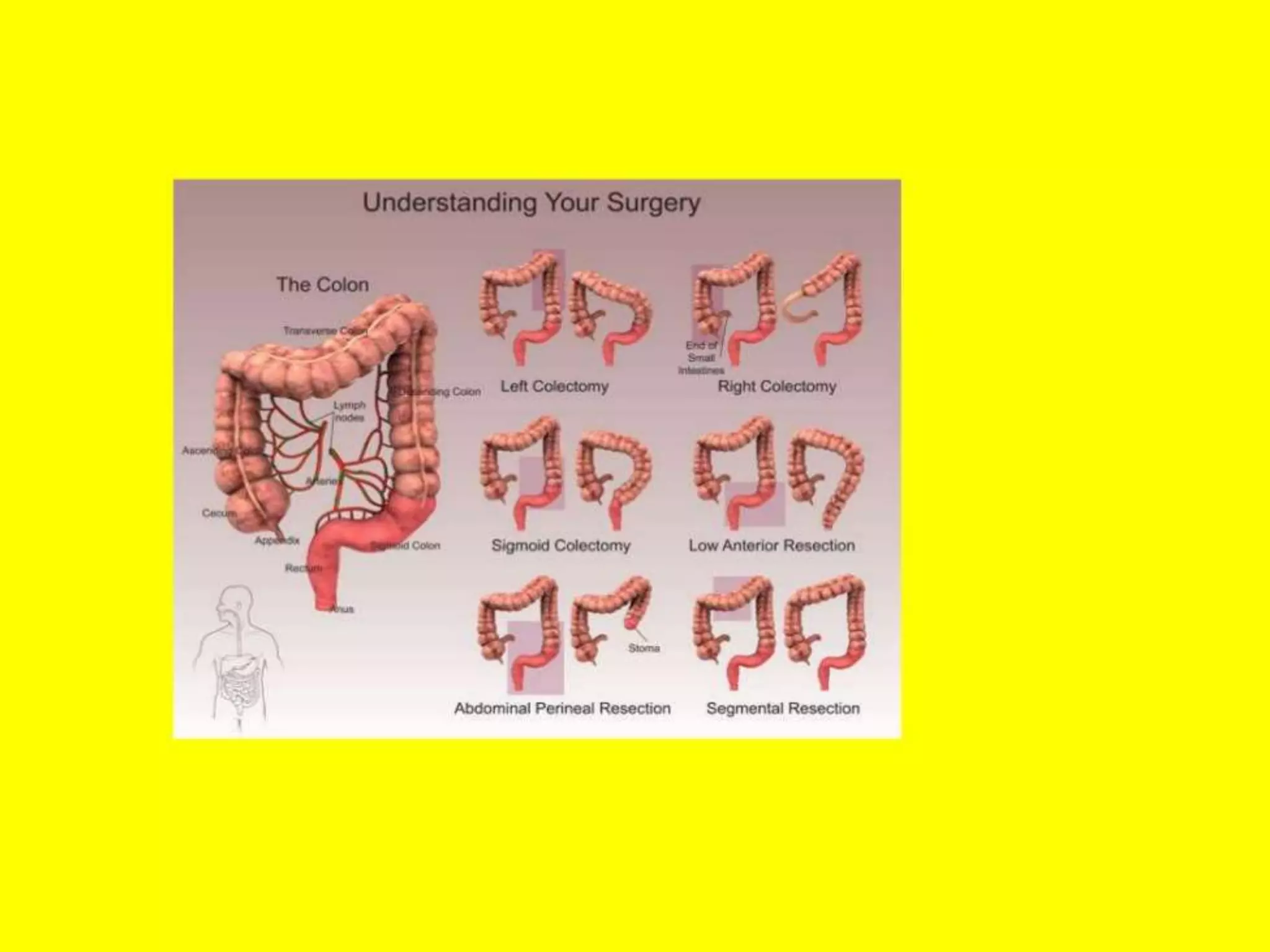 BLEEDING PER RECTUM BASIC MEDICAL KNOWLEDGE & MANAGEMENT.ppt