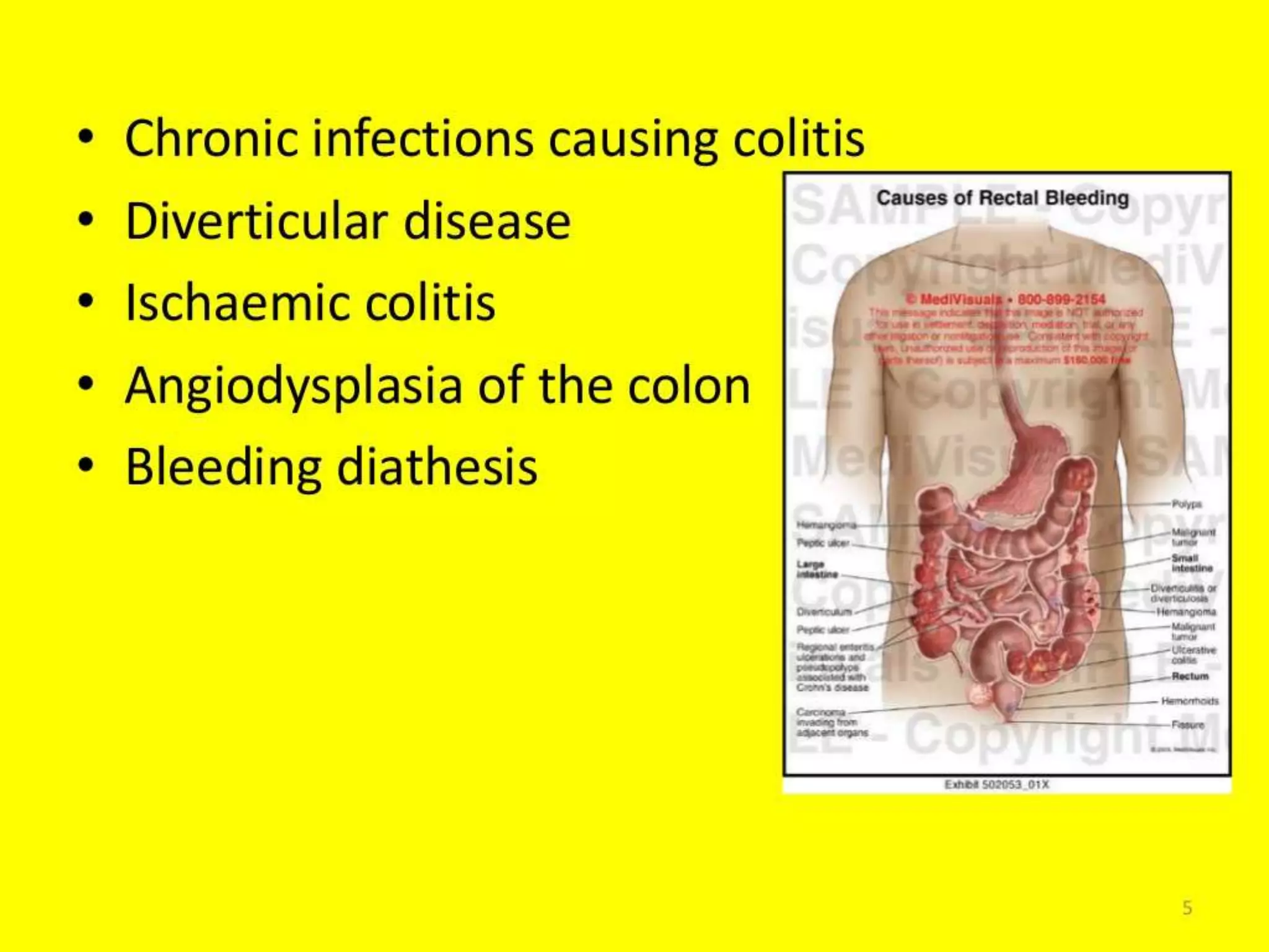 BLEEDING PER RECTUM BASIC MEDICAL KNOWLEDGE & MANAGEMENT.ppt