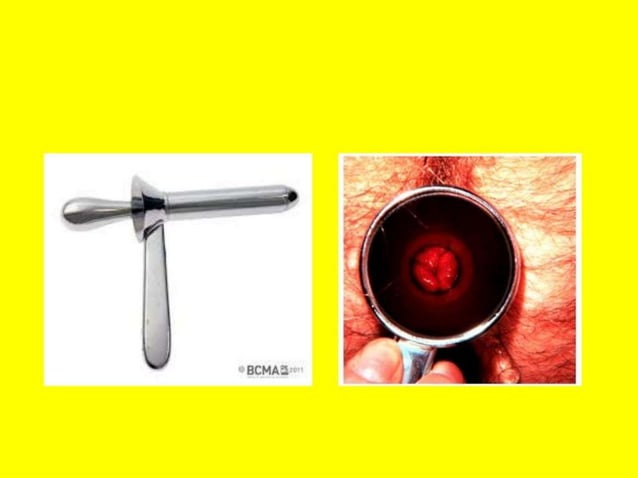 BLEEDING PER RECTUM BASIC MEDICAL KNOWLEDGE & MANAGEMENT.ppt