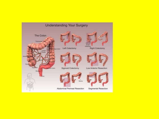 BLEEDING PER RECTUM BASIC MEDICAL KNOWLEDGE & MANAGEMENT.ppt