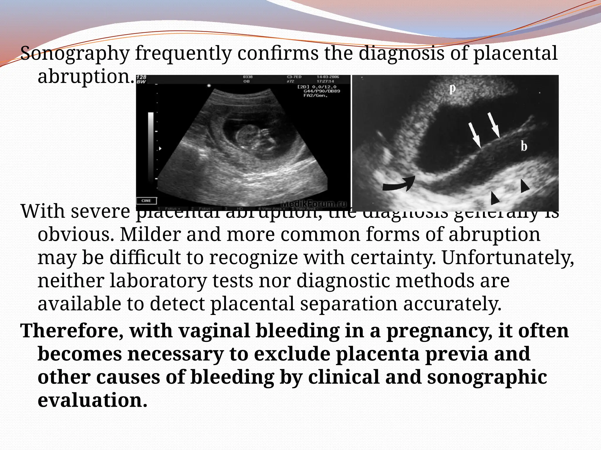 Bleeding pregnancy, labor, puerperium.pptx
