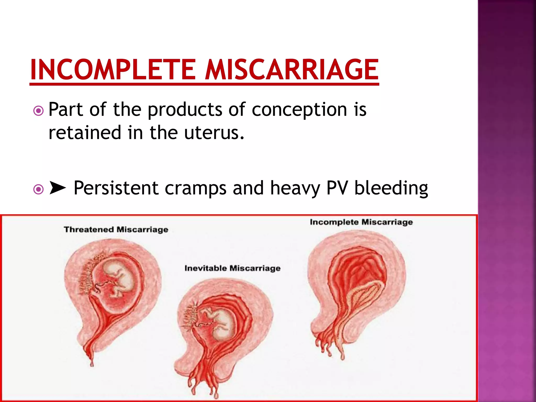 Bleeding pv BY DR TOUSIF SHEIKH | PPTX