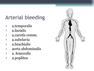 Bleeding shock | PPT