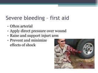 Bleeding shock | PPT