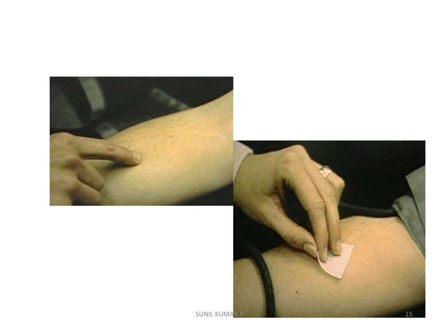 Bleeding time and clotting time | PPTX