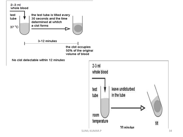 Bleeding time and clotting time | PPTX