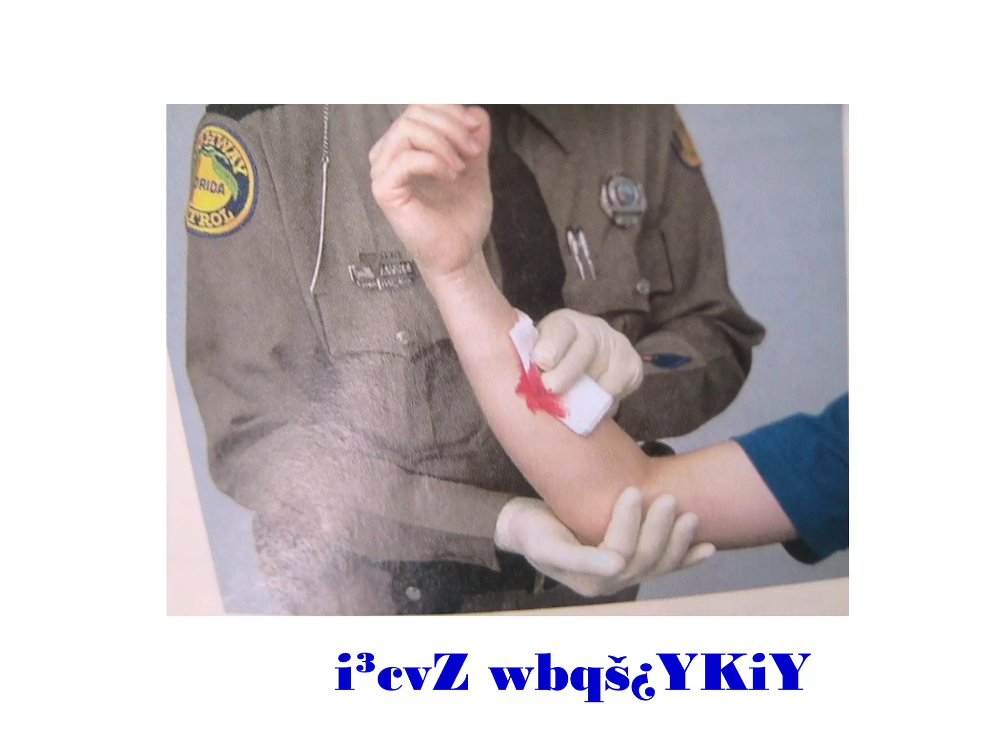 Bleeding & wounds | PPT
