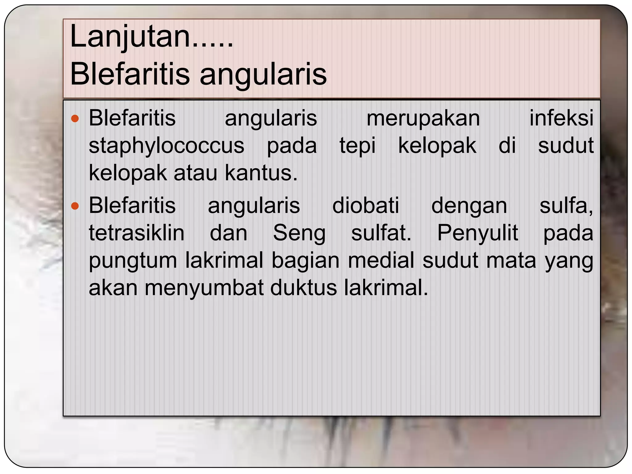 Blefaritis | PPTX