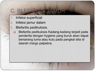 Blefaritis | PPTX