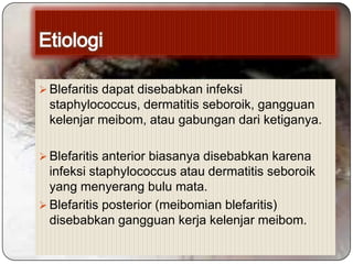 Blefaritis | PPTX