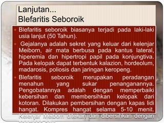 Blefaritis | PPTX