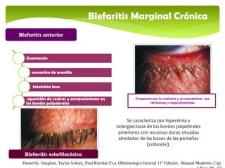 Blefaritis, Orzuelo y Chalazión | PPTX